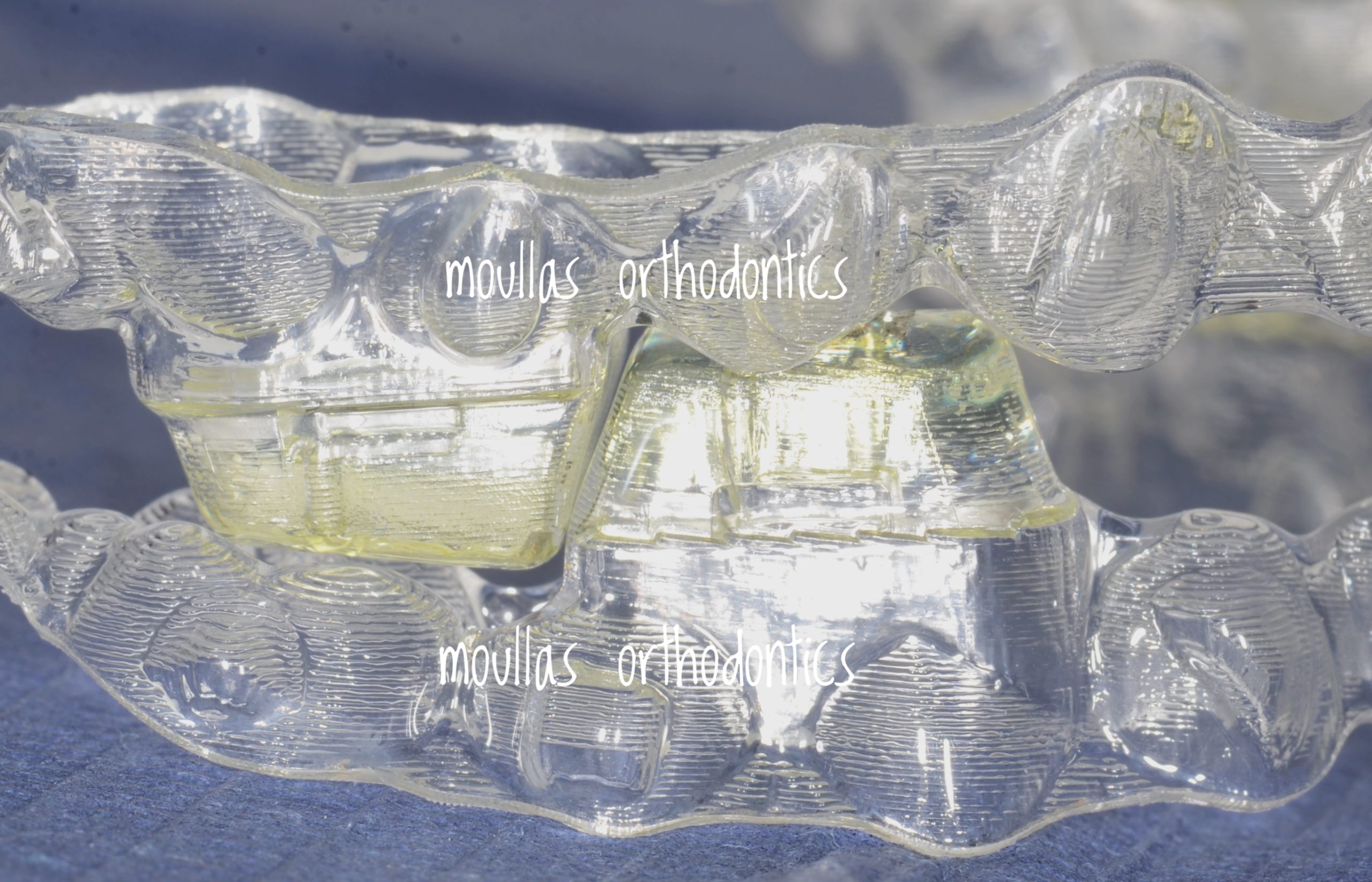Invisalign Teen | Άνετη Διόρθωση ορθοδοντικών προβλημάτων